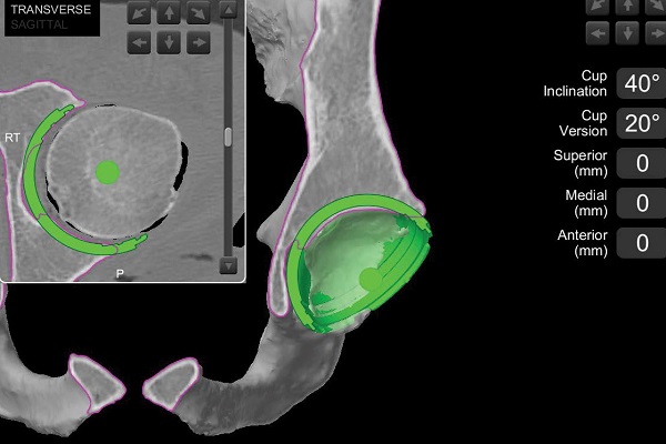 整形外科トピックス
